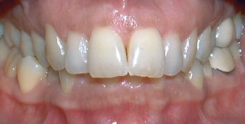 Common Orthodontic Problems Georgetown TX | Georgetown Orthodontics